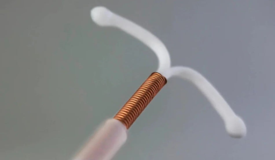 DIU x Implanon: o que precisa saber para escolher o contraceptivo