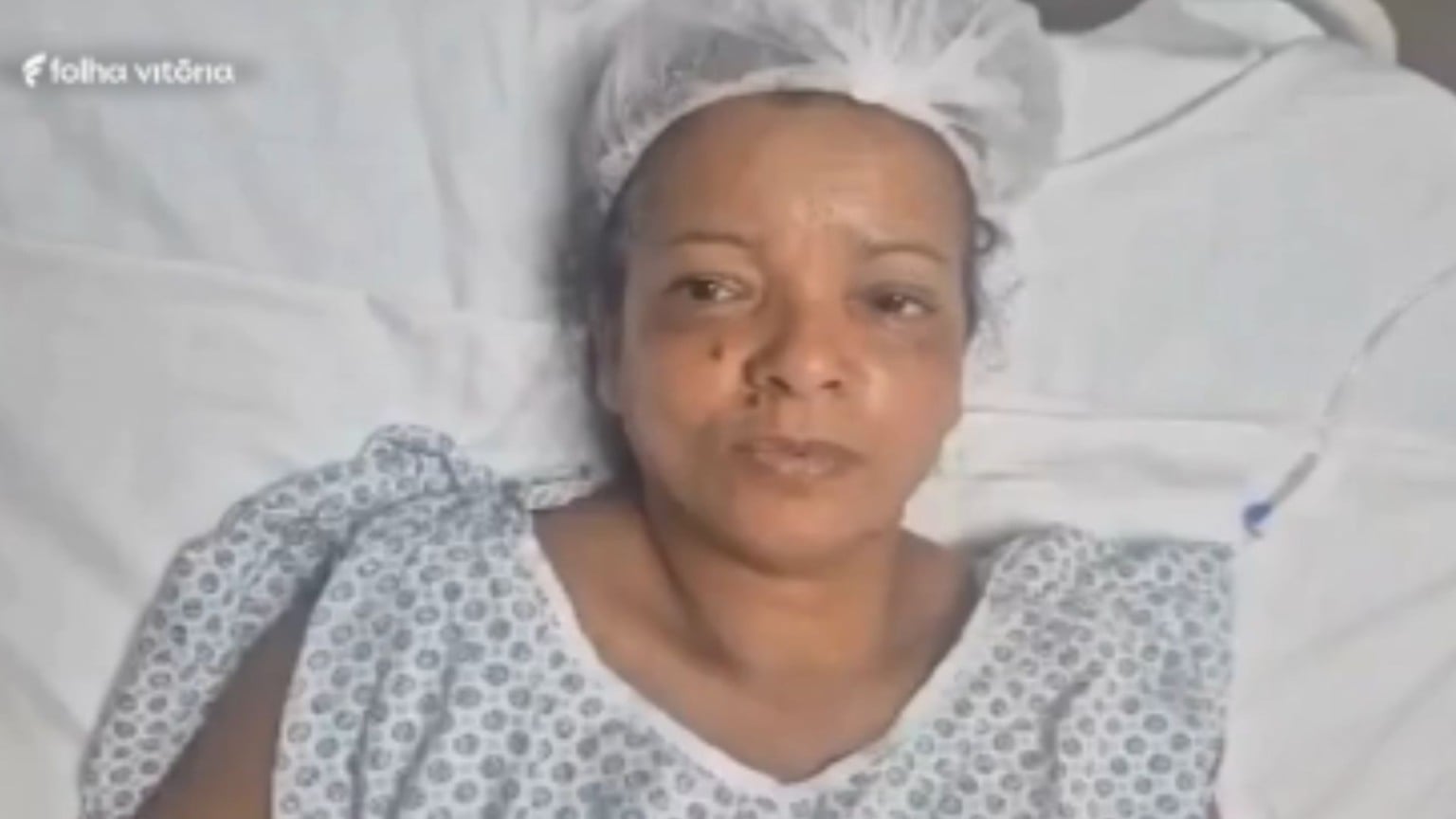 Passageira leva 11 pontos na cabeça após acidente em ônibus